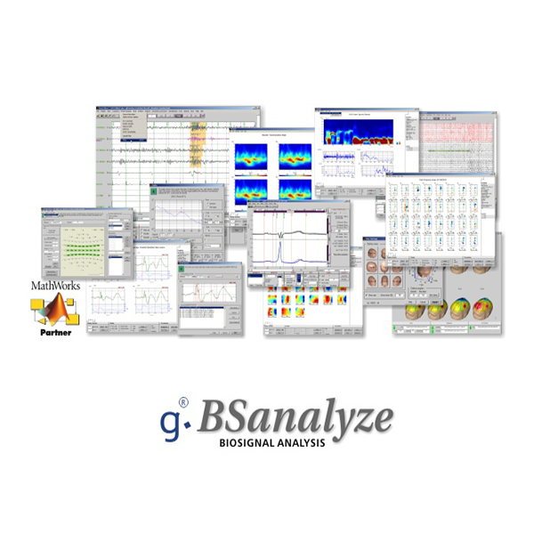 g.BSanalyze - for multimodal biosignal processing - NBT